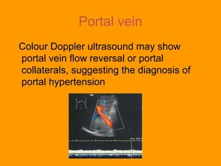 Liver transplant evaluation | PPT