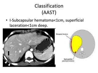 Liver trauma: A comprehensive review of classification, mechanisms ...