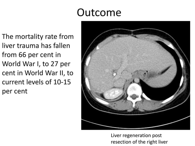 Liver trauma: A comprehensive review of classification, mechanisms ...