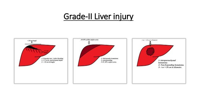 Liver trauma الدكتور طارق المنيزل