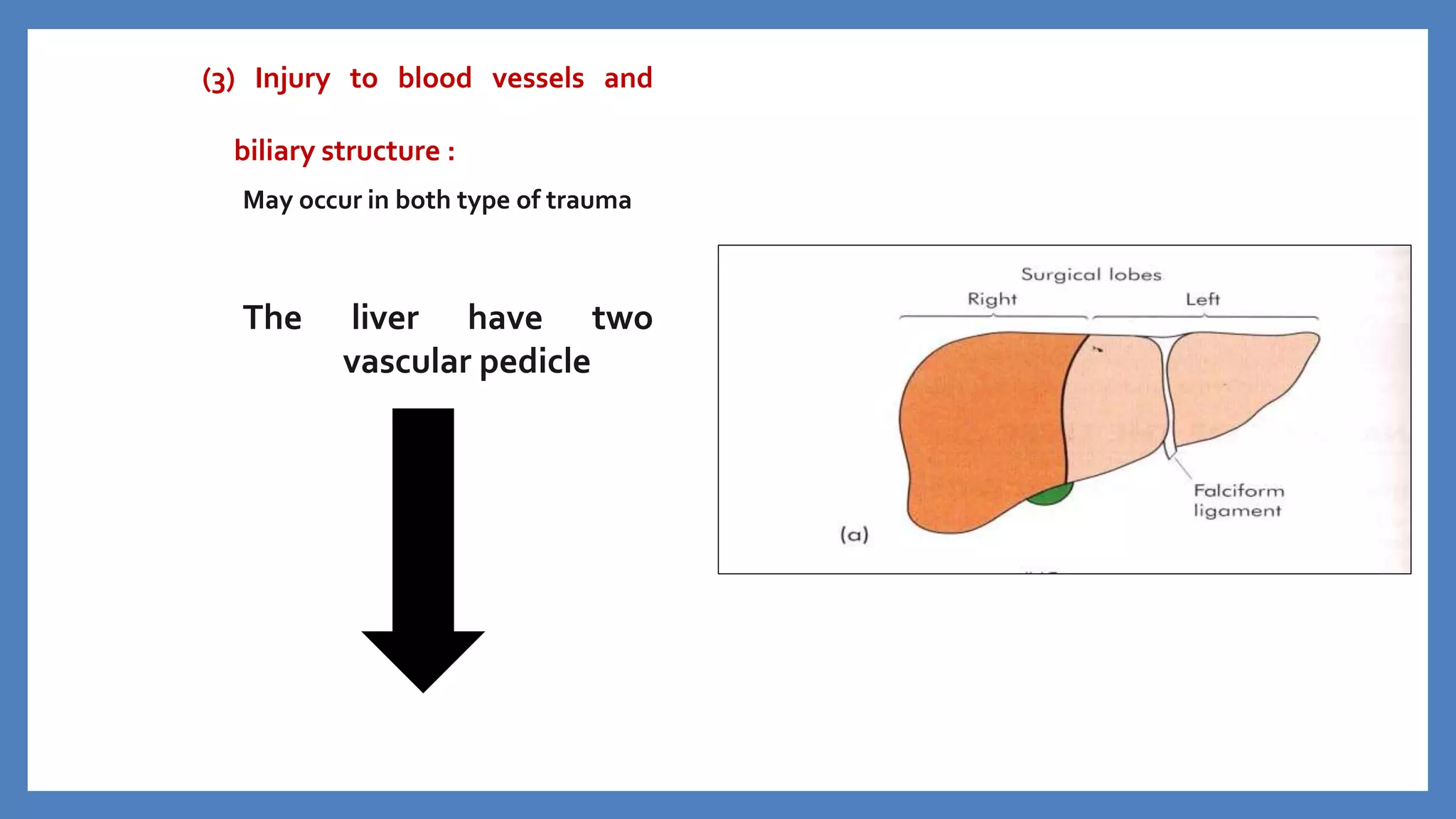 liver trauma.pptx