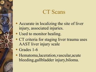 Curso de Trauma - Case de Trauma de Higado | PPT