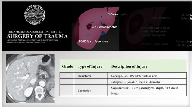 Liver Trauma - World Journal of Emergency Surgery.pptx