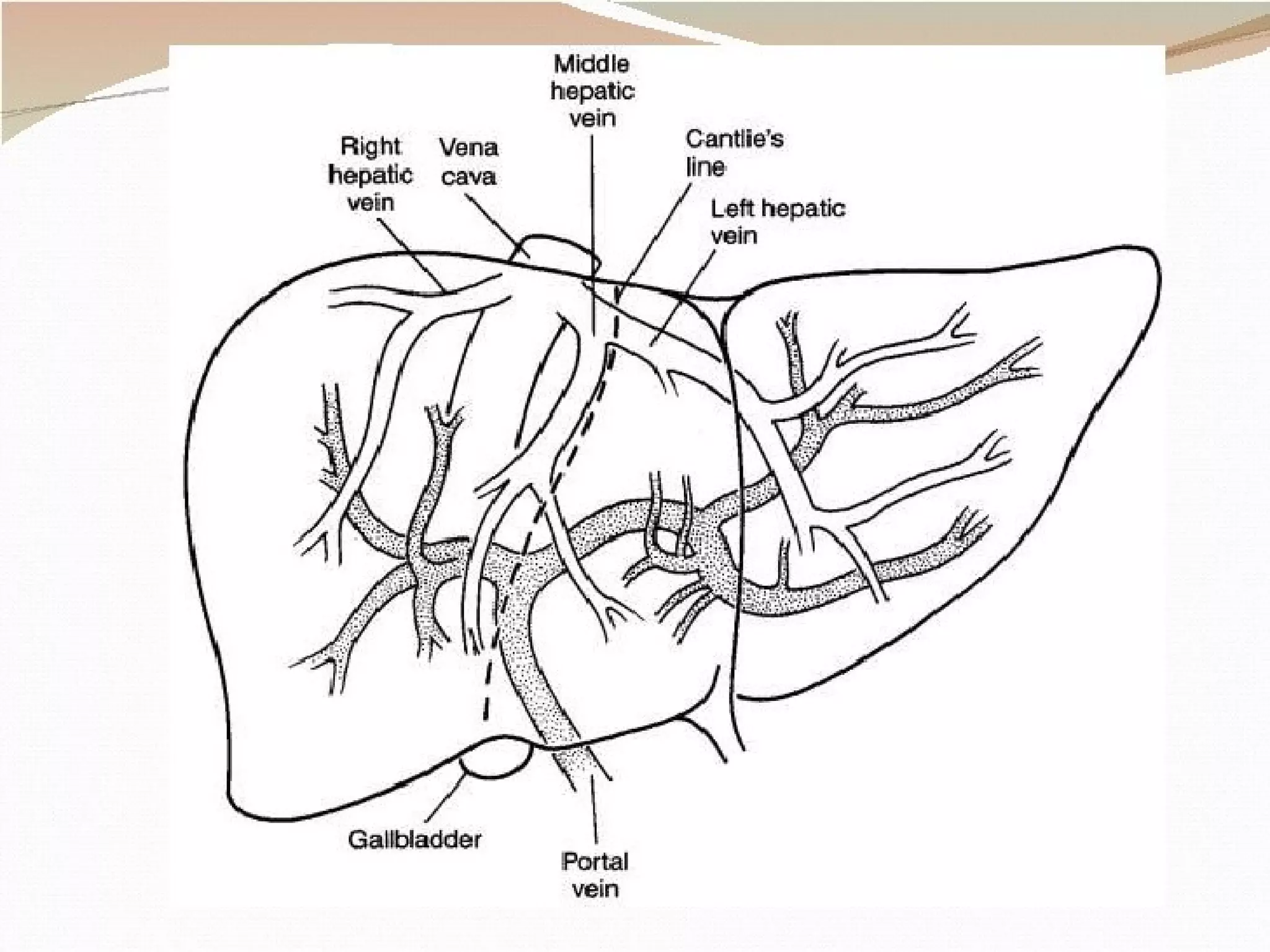 Liver Trauma (Liver Injury) | PPT