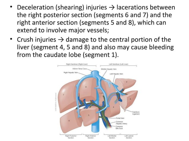 Liver Trauma (Liver Injury) | PPT