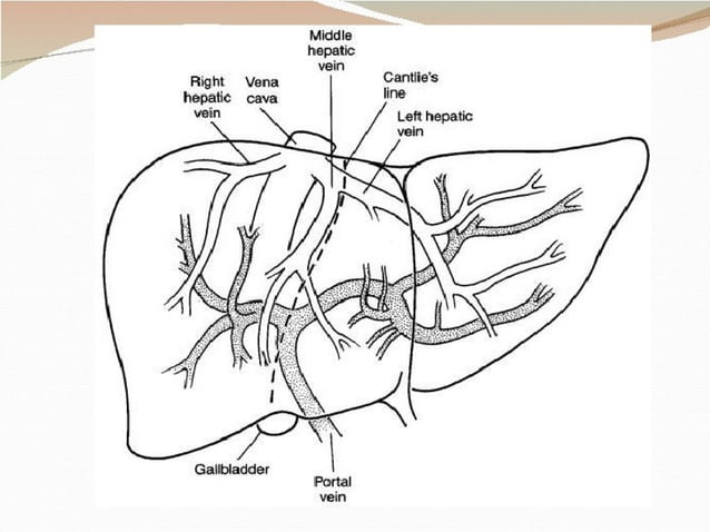 Liver Trauma (Liver Injury) | PPT