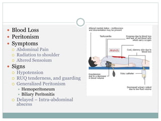 Liver Trauma & Concepts in Abdominal Trauma Lecture | PPTX