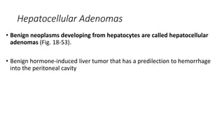 Liver tumors [Benign and Malignant] | PPTX