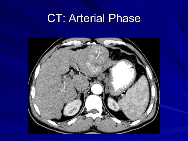 Liver tumors - A basic guide to diagnose and treat liver tumors