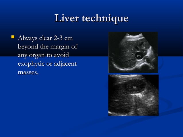 Liver ultrasound | PPT