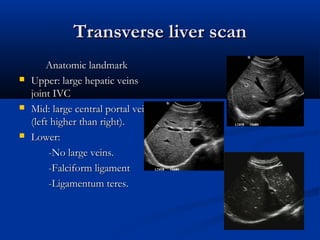 Liver Ultrasound Anatomy