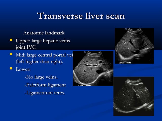 Liver Ultrasound