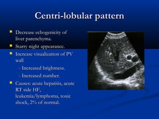 Liver ultrasound | PPT