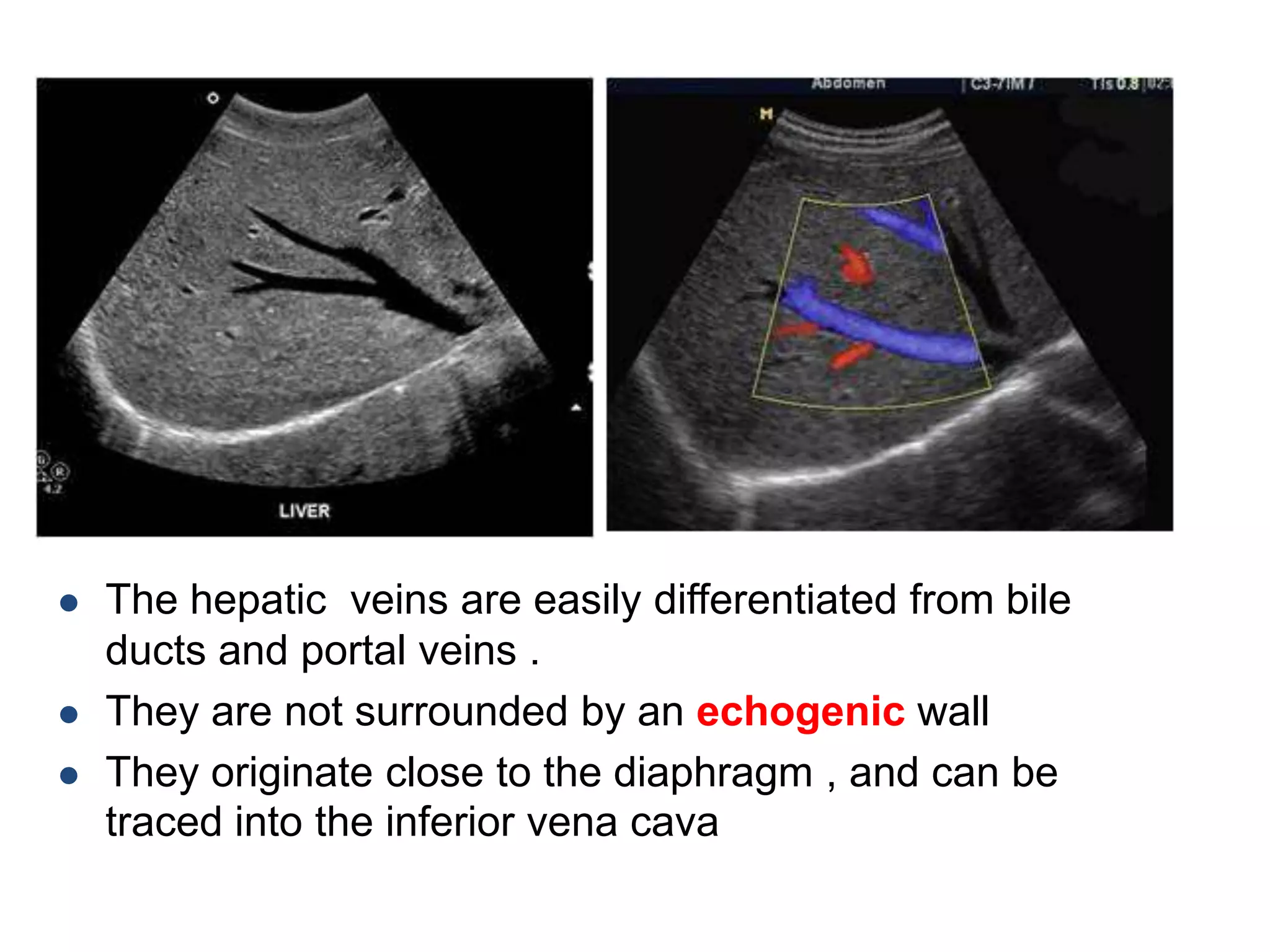liver ultrasound.pptx
