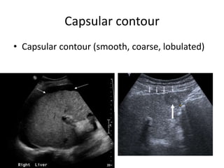 liver ultrasound.pptx