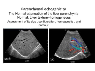 liver ultrasound.pptx