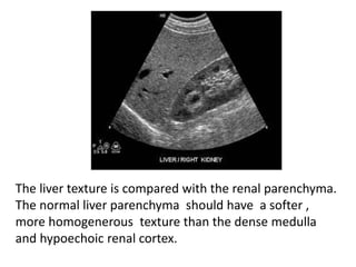 liver ultrasound.pptx