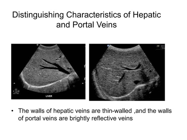 liver ultrasound.pptx