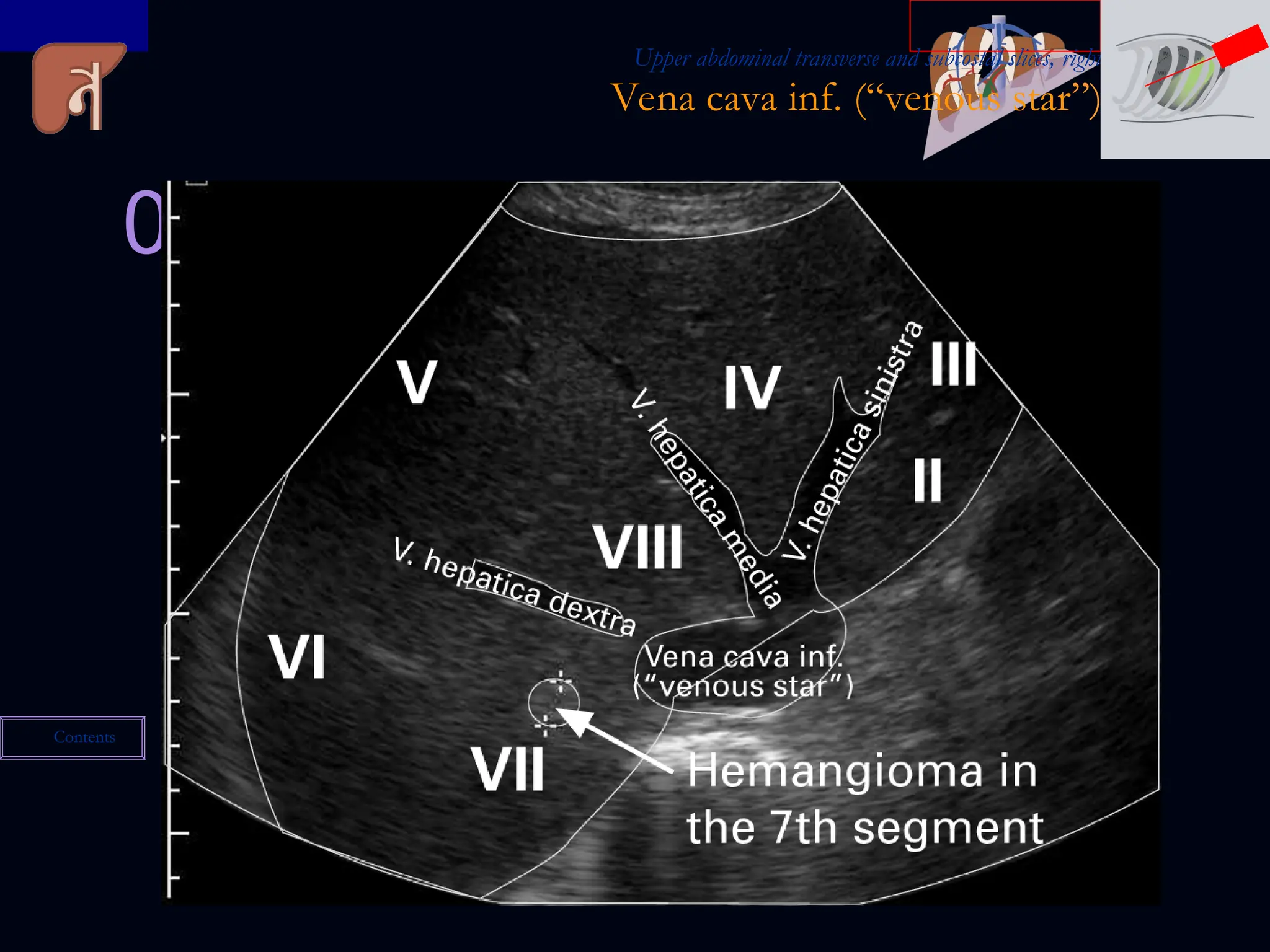 liver Ultrasonography powerpoint presentation .ppt