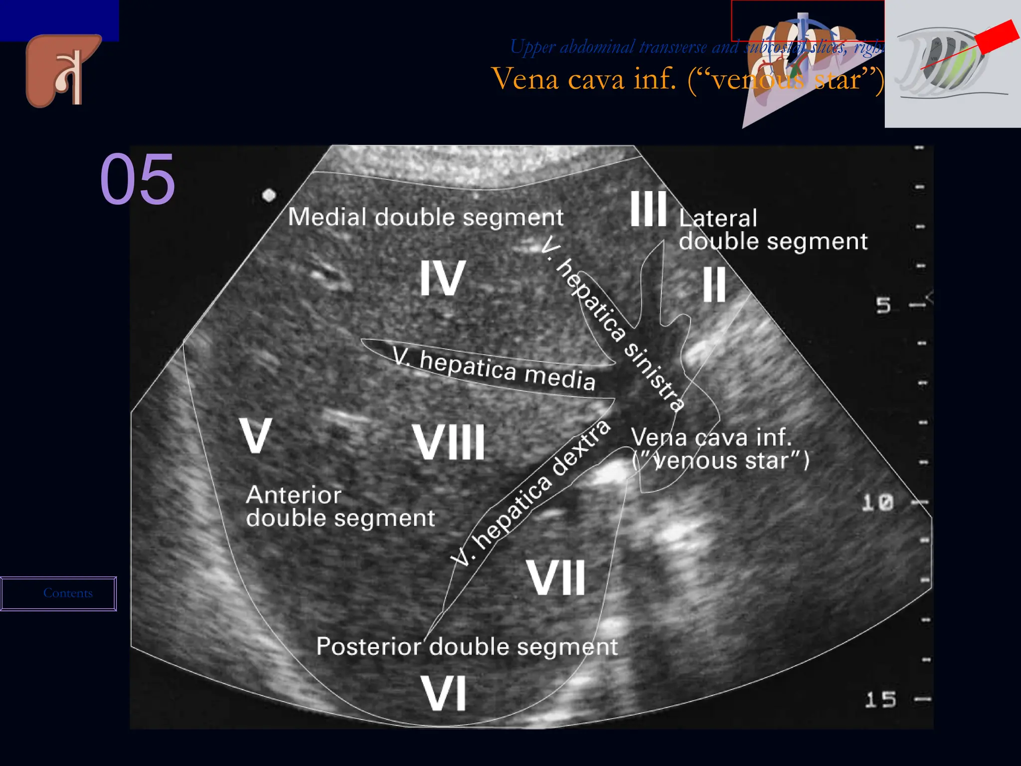 liver Ultrasonography powerpoint presentation .ppt