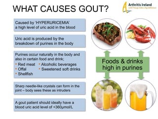 Living with gout - Prof. Geraldine McCarthy | PPTX