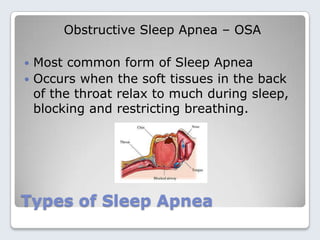 Living with Sleep Apnea | PPTX