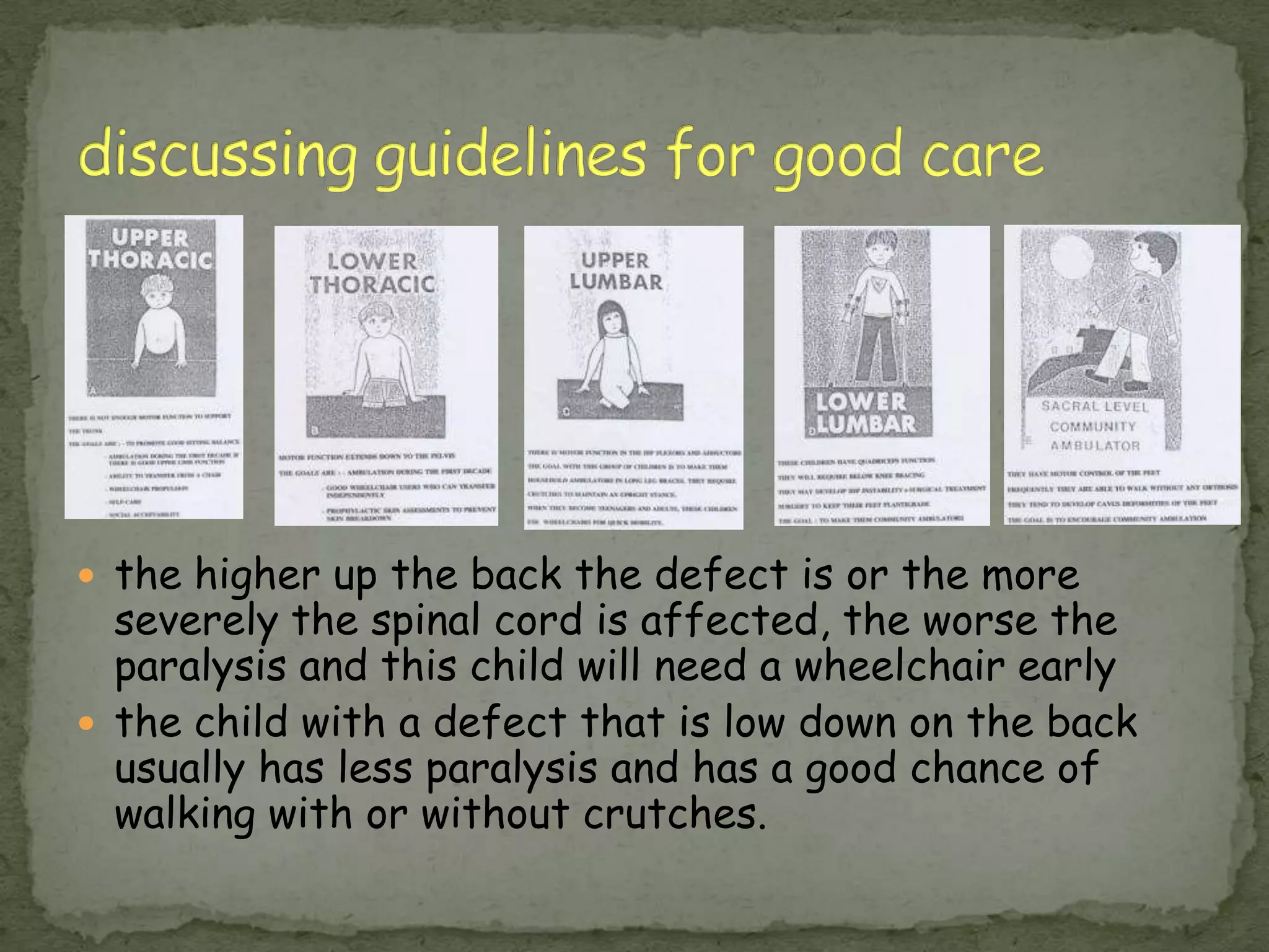 Living with spina bifida and hydrocephalus in developing countries ...