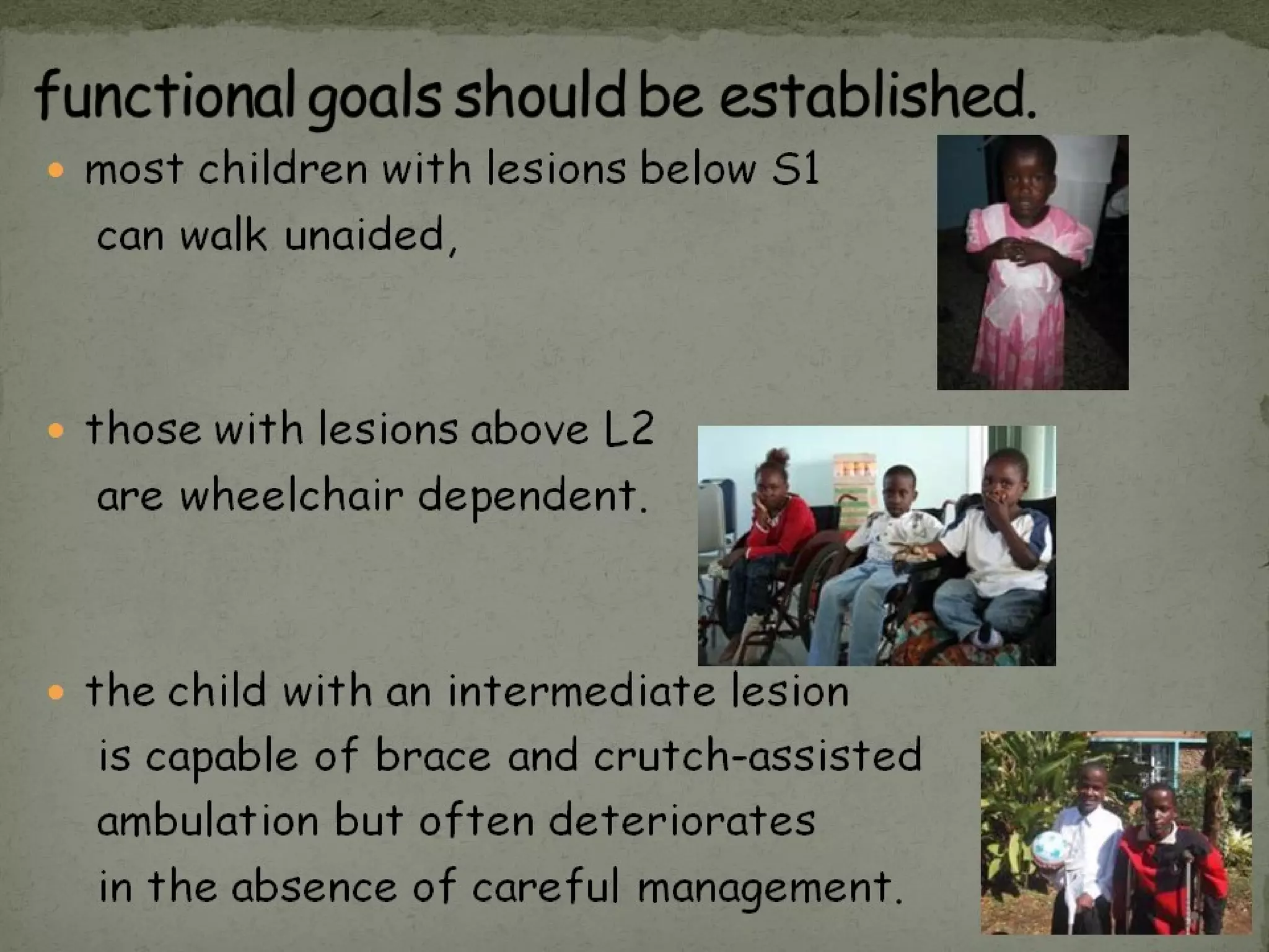 Living with spina bifida and hydrocephalus in developing countries ...