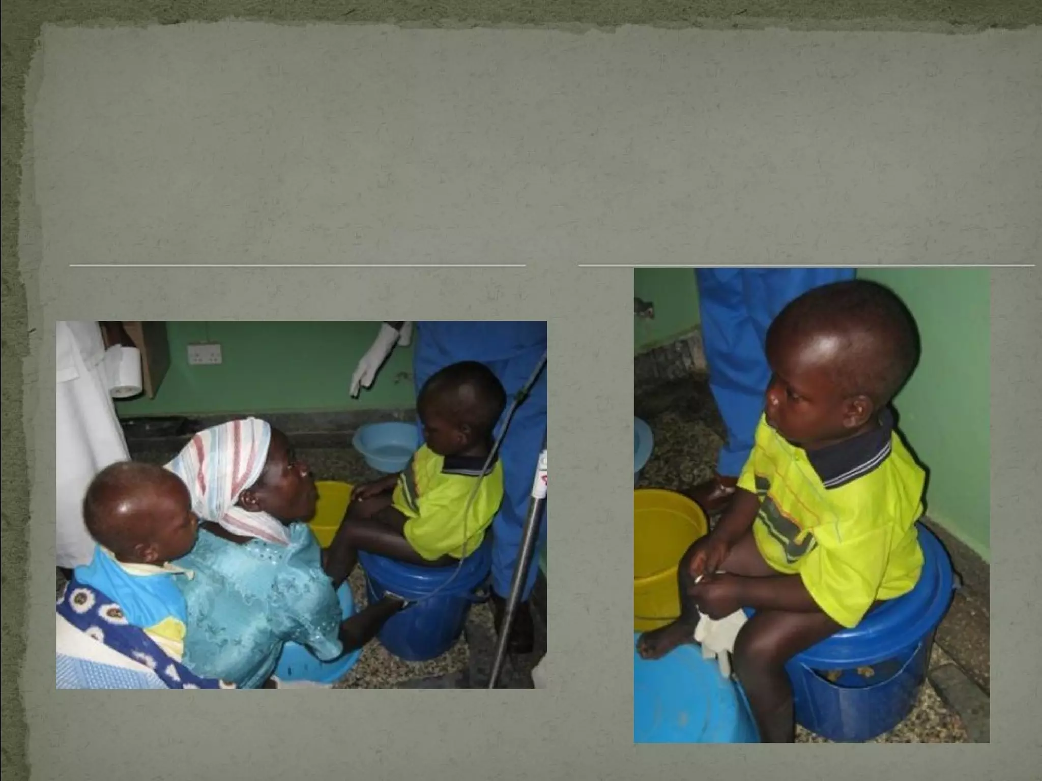 Living with spina bifida and hydrocephalus in developing countries ...