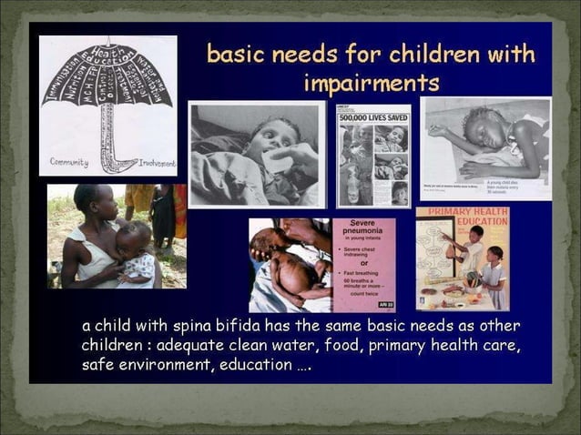 Living with spina bifida and hydrocephalus in developing countries ...