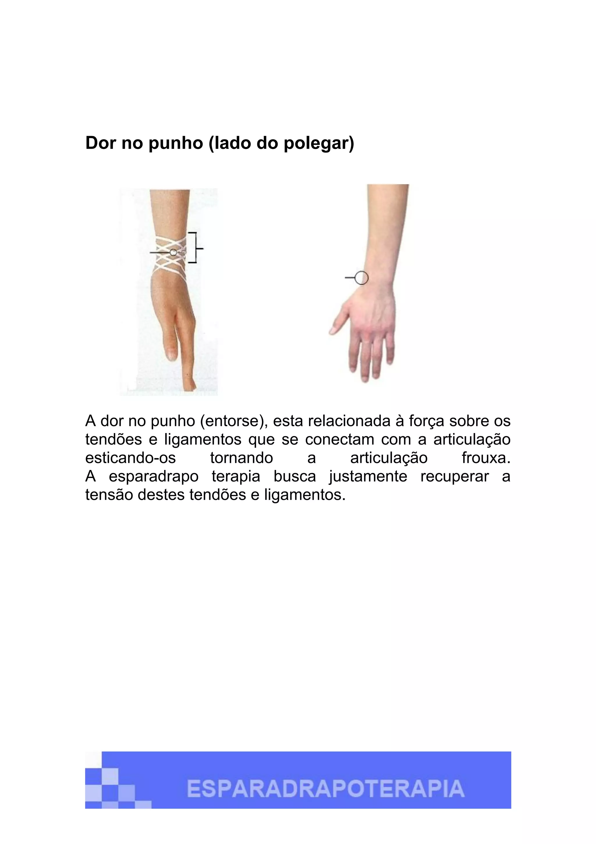 Spiral taping ou esparadrapoterapia | PDF
