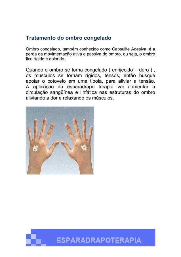 Spiral taping ou esparadrapoterapia | PDF