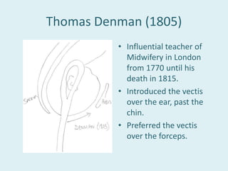 Competing 19th Century Midwifery Instruments; Forceps/Vectis Rivalry ...