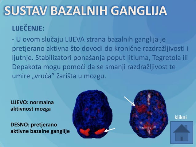 Ljudski mozak-Human brain-by Katarina Bukarica-Zadar-Croatia | PPT