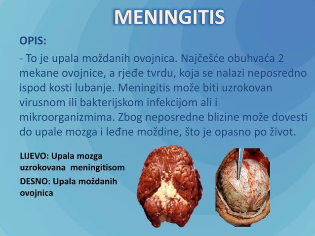 Ljudski mozak-Human brain-by Katarina Bukarica-Zadar-Croatia | PPT