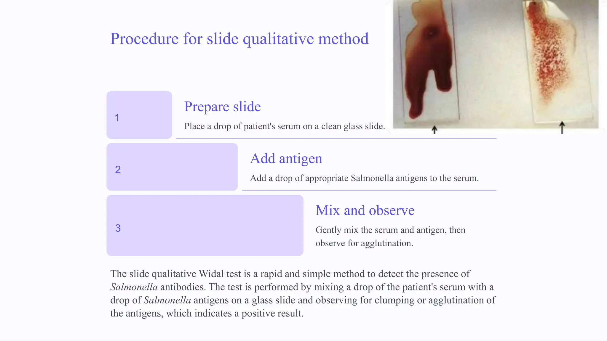 Widal Agglutination Test:A rapid serological diagnosis of typhoid fever ...