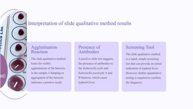 Widal Agglutination Test:A rapid serological diagnosis of typhoid fever ...