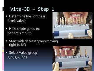 Shade Selection techniques | PPTX
