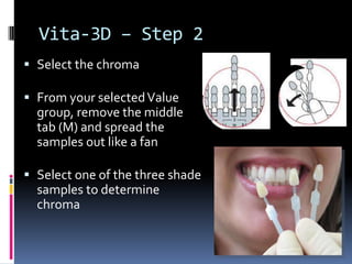 Shade Selection techniques | PPTX