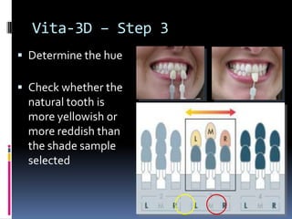 Shade Selection techniques | PPTX