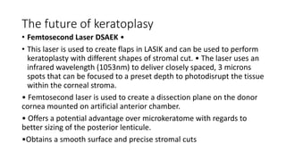 Lamellar Keratoplasty in ophthalmology | PPT