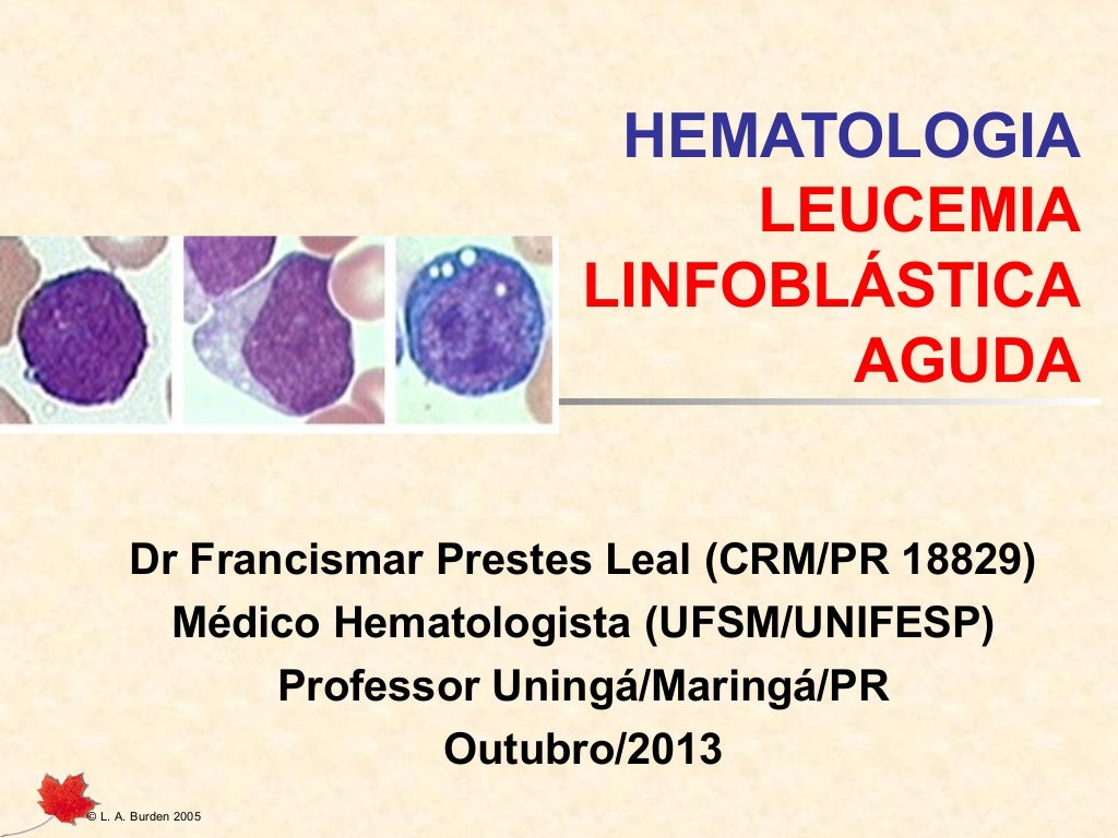 Leucemia Linfoblástica Aguda (LLA)