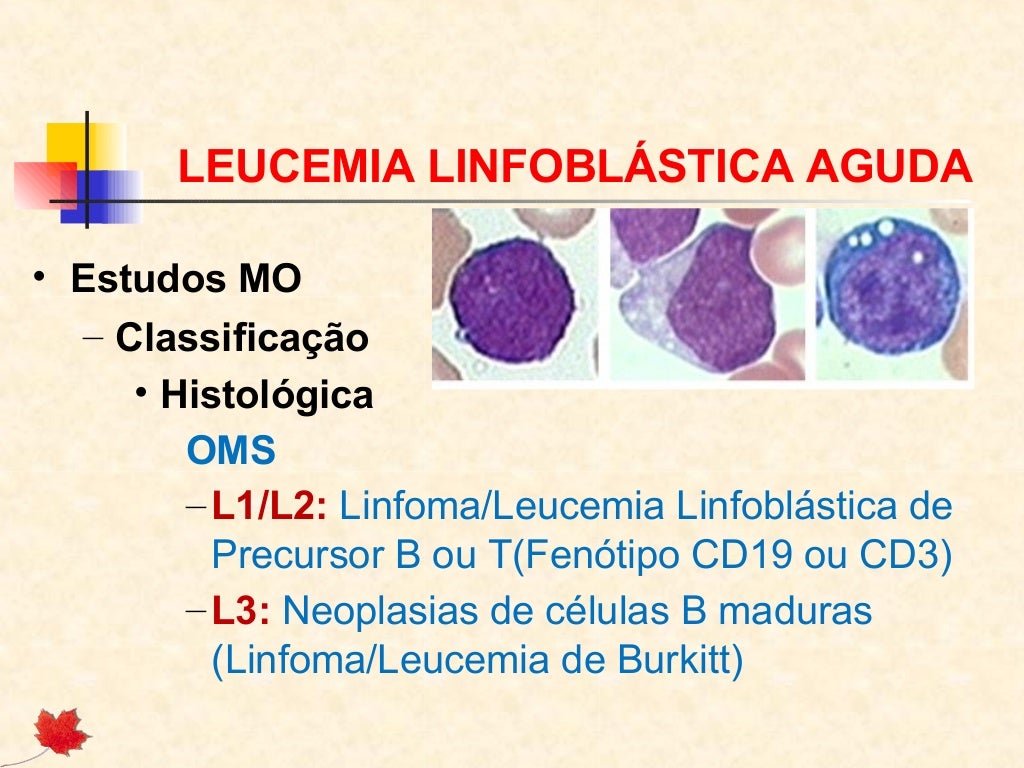 Leucemia Linfoblástica Aguda (LLA)
