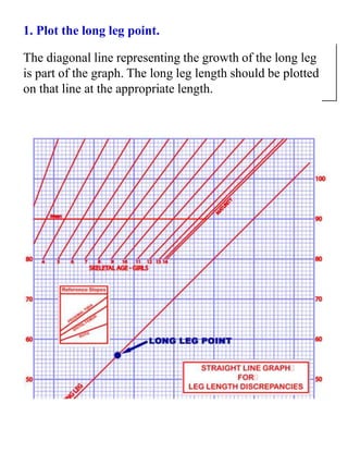 limb length discrepancy | PPTX