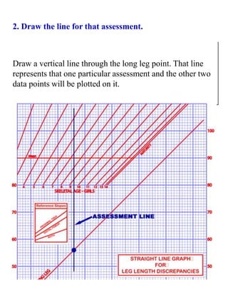 limb length discrepancy | PPTX