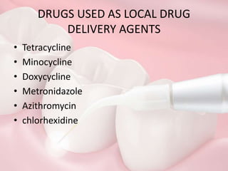 LOCAL DRUG DELIVERY | PPTX