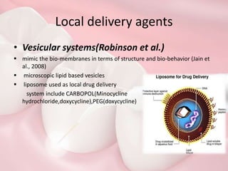 LOCAL DRUG DELIVERY | PPT