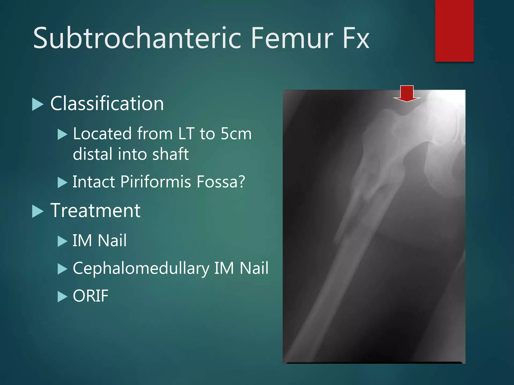 Lower Limb Fractures.pptx