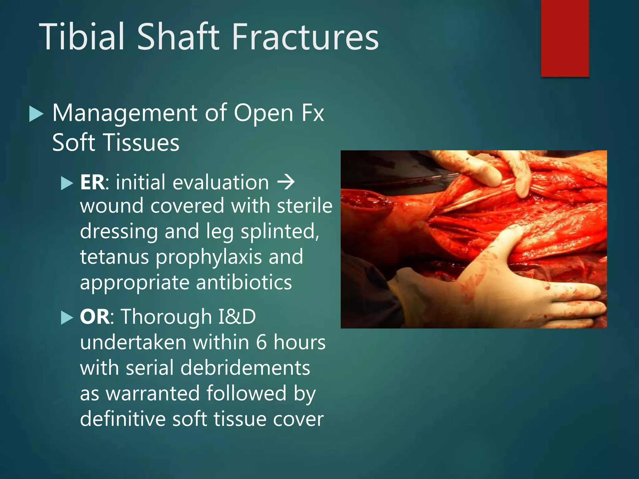 Lower Limb Fractures.pptx