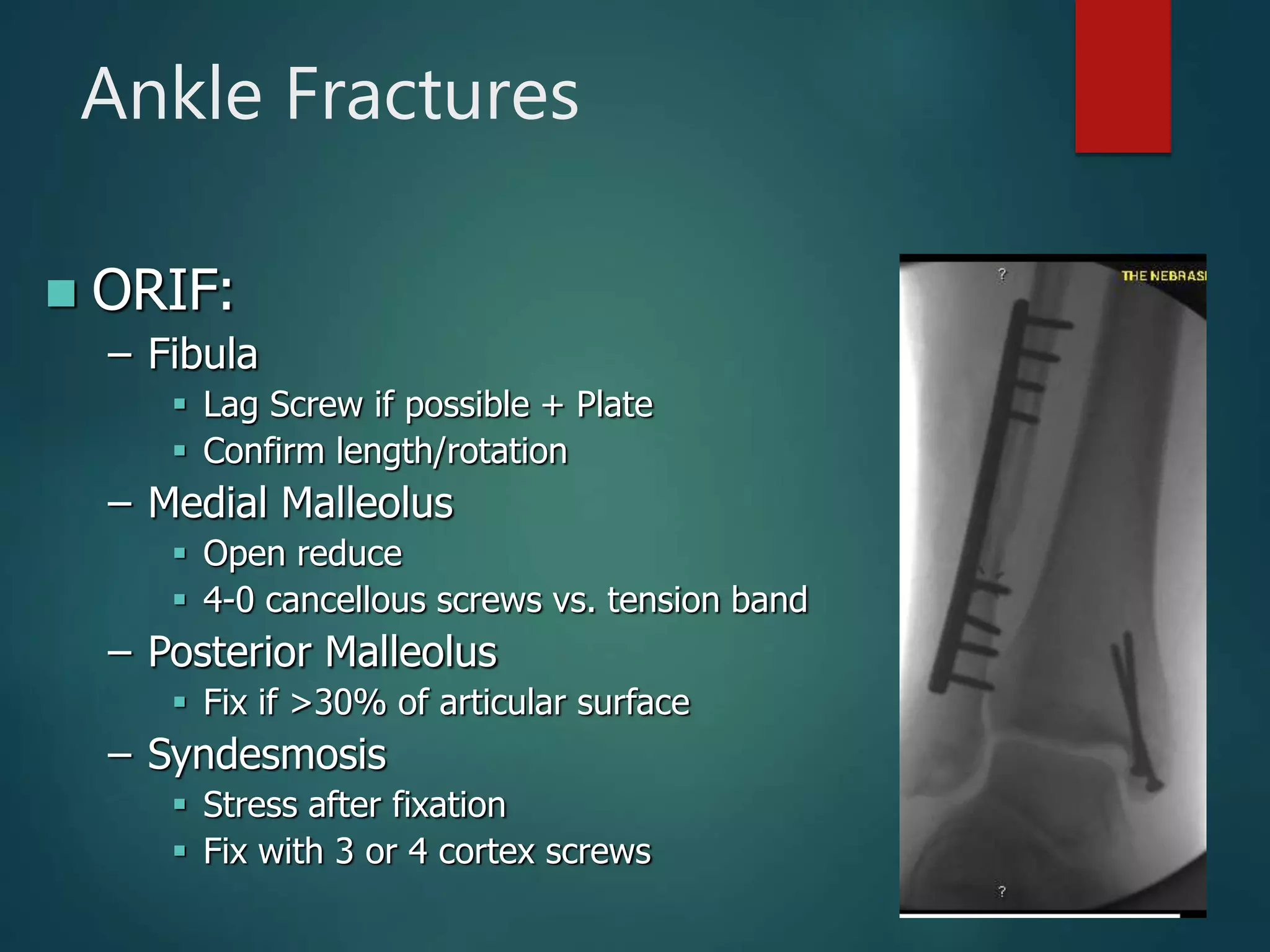 Lower Limb Fractures.pptx